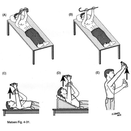 Rehabilitation After Shoulder Arthroplasty UW Orthopaedic Surgery And Rehabilitation After Shoulder Arthroplasty UW Orthopaedic Surgery And
